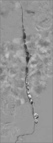 D2RS Remote-Controlled Fluoroscopy Systems | Stephanix