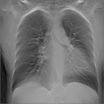 D2RS Remote-Controlled Fluoroscopy Systems | Stephanix
