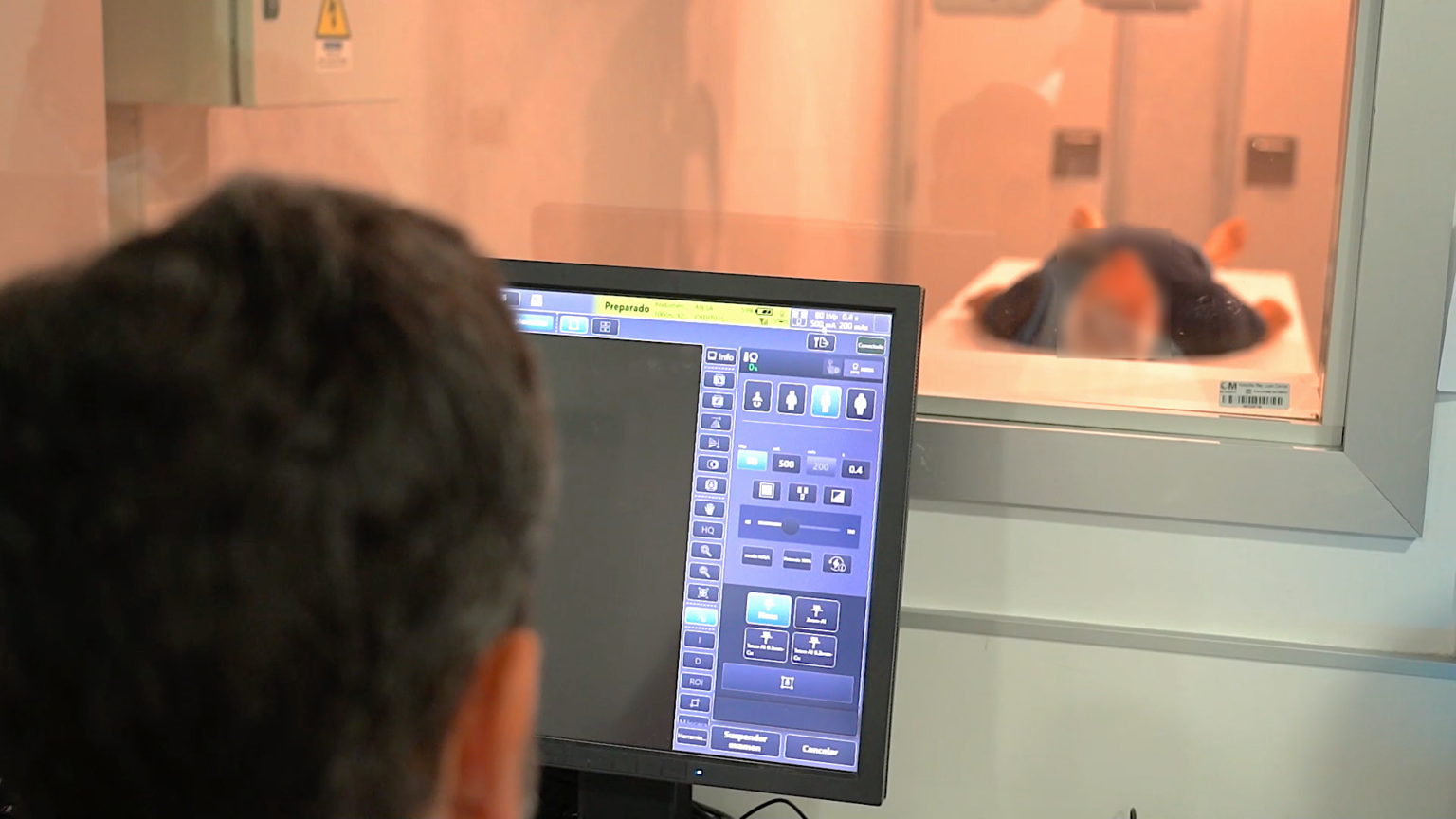 Digital Radiography | Rad room | Stephanix - Xtreme Premium