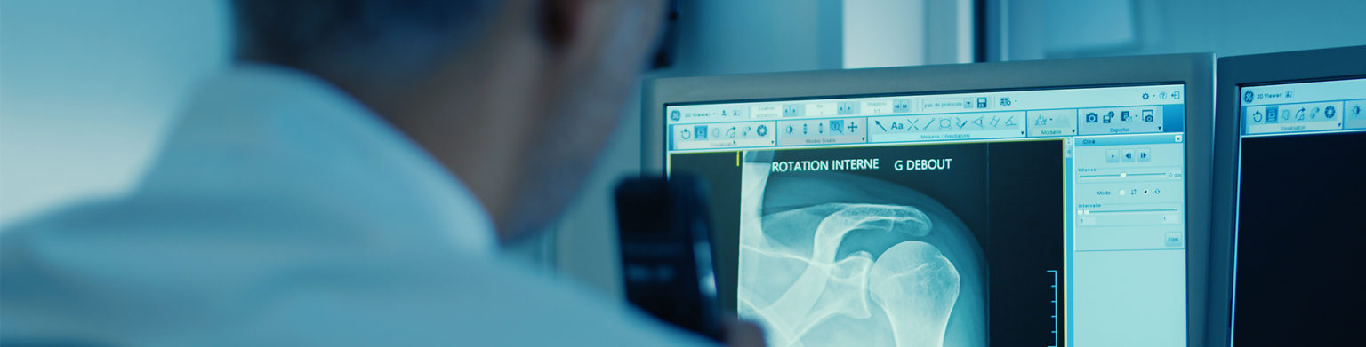 Mobile X ray radiography systems | Stephanix